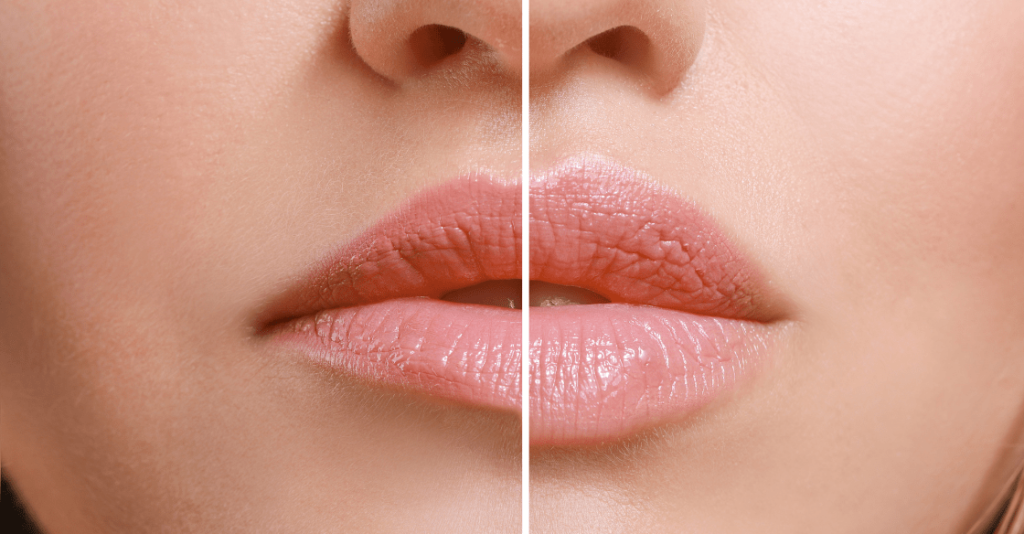 Non Invasive Cosmetic Procedures: Alternatives to Plastic Surgery