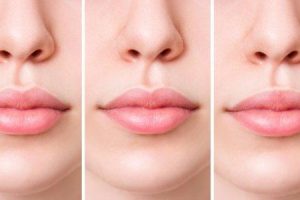 14 Lip Filler Shapes: How To Choose The Right Type